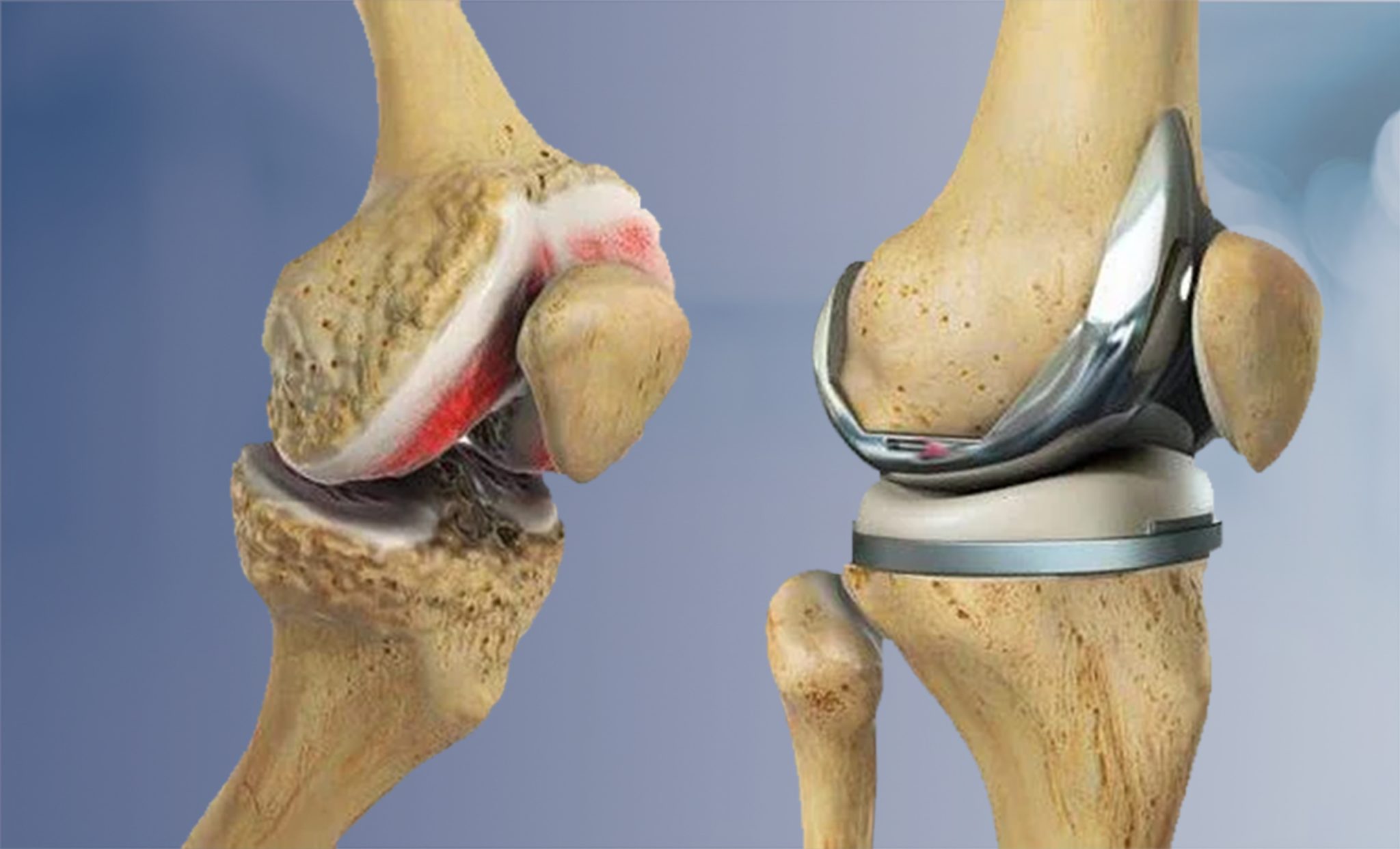 Knee – Flex Knee And Shoulder Clinic